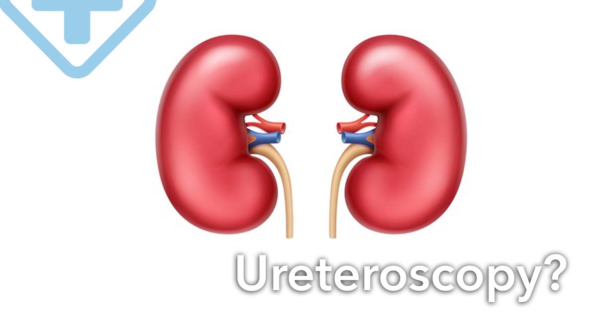 Ureteroscopy: Before, During & After