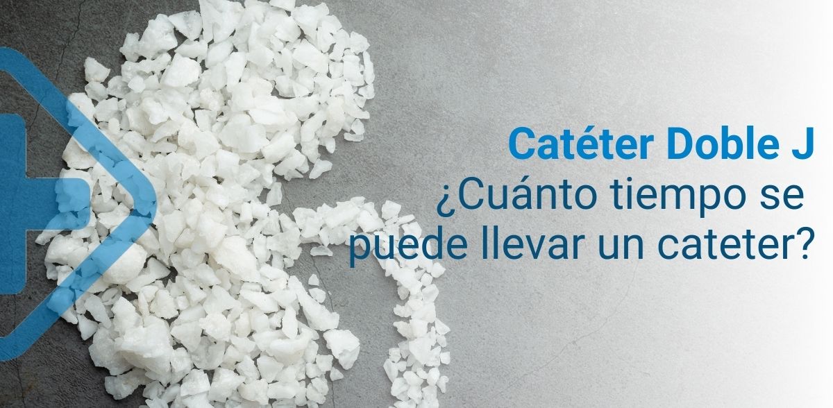 Catéter doble J: Antes, Durante Y Después De La Cirugía