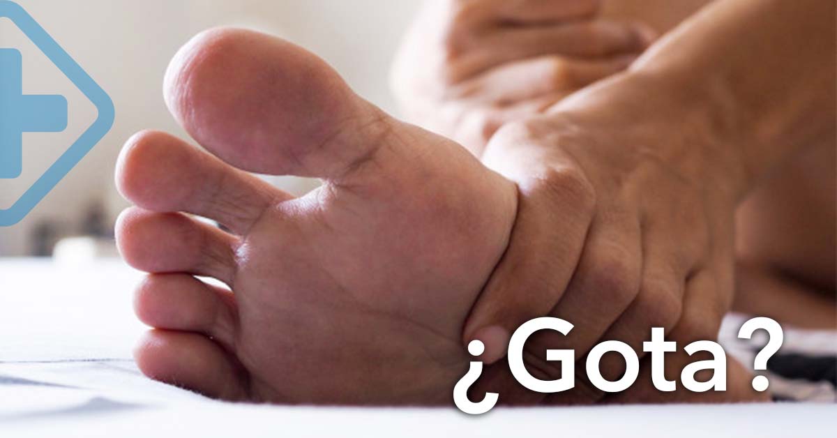 Gota: Causas, Síntomas, Diagnóstico & Tratamiento